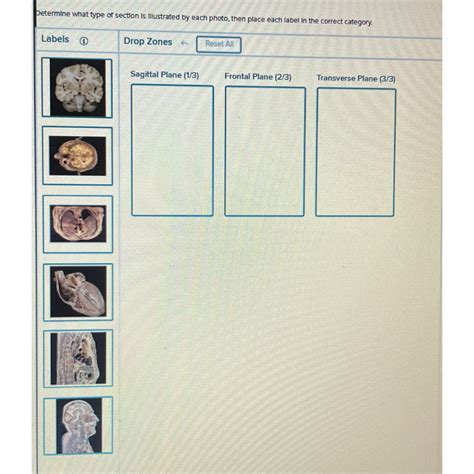 Solved Determine What Type Of Section Is Illustrated By Each Chegg