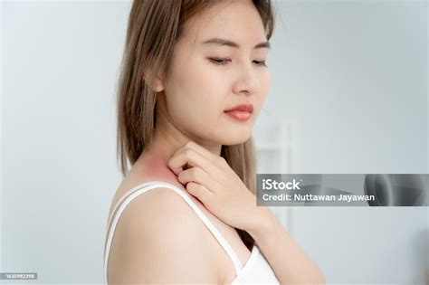 피부 문제와 아름다움 젊은 여성 스크래치 몸은 피부 알레르기 스테로이드 알레르기 민감한 피부 햇볕에 타는 붉은 색 화학 알레르기