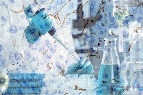 Oncology Research Icbas