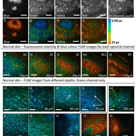 Multispectral Fluorescence Intensity And Flim Images Acquired From