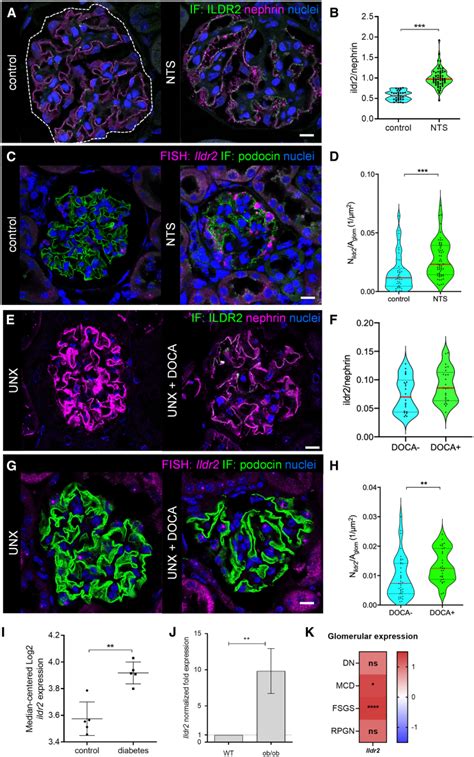 The Role Of The Tricellular Junction Protein Ildr2 In Glomerulopathies