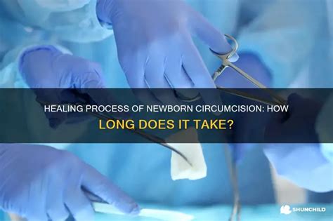 Healing Process Of Newborn Circumcision: How Long Does It Take? | ShunChild