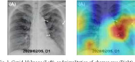 Figure 1 From Reinforced Cascading Convolutional Neural Networks And