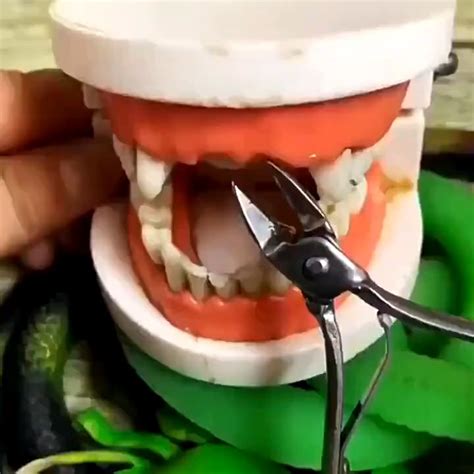 Temporary Tooth Repair Kit Teeth And Gaps Moldable Falseteeth Solid