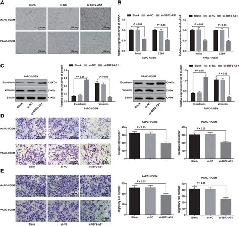 Long Non Coding Sbf2 As1 Acting As A Competing Endogenous Rna To Sponge