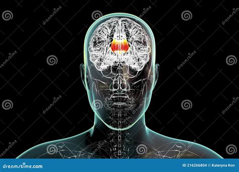 Human Brain With Highlighted Corpus Callosum Also Known As Callosal