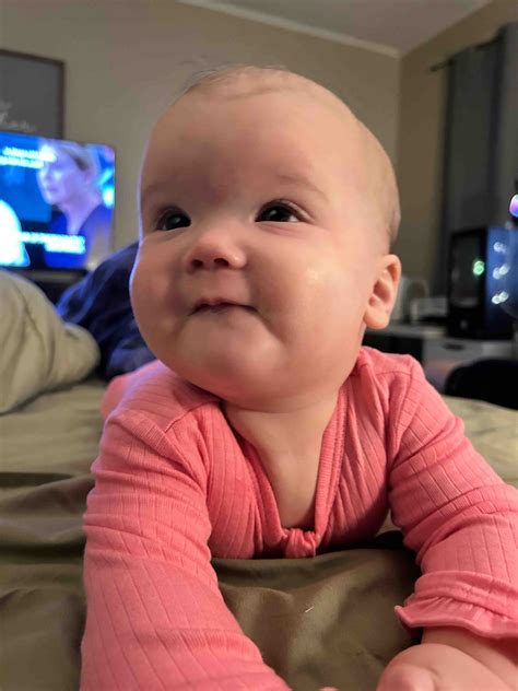 Fundraiser By Taylor Bloss Scaphocephaly Treatment
