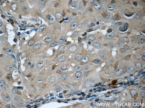 ITPA Antibody AP Proteintech
