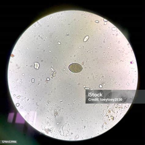 Photo Libre De Droit De Parasite Et Protozoaire Dans Lexamen De Selles