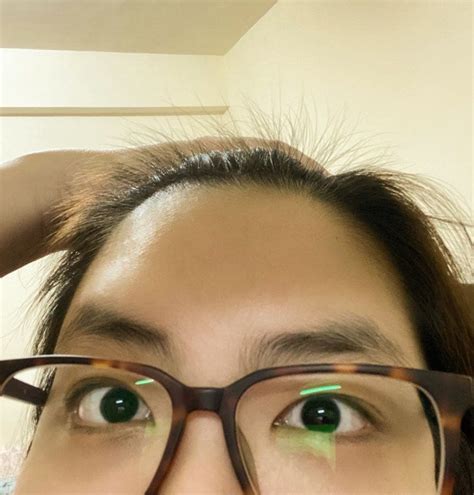 育兒 產後落髮 親子板 Dcard