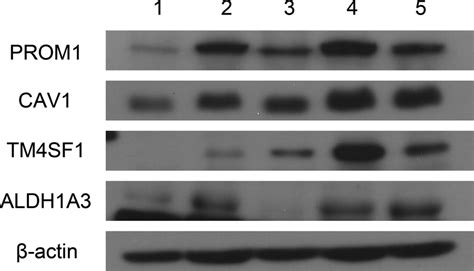 Validation Of Microarraybased Gene Expression By Western Blot