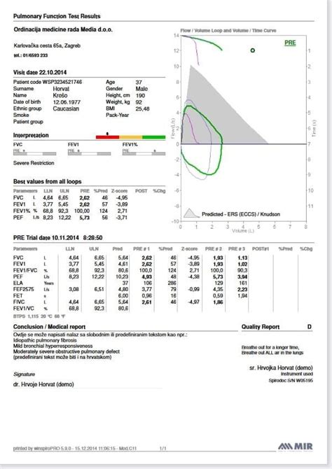 Spirometar Spirolab Iv Media Instrumenti