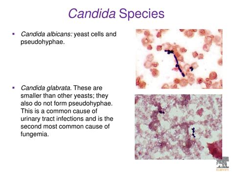Ppt Laboratory Diagnosis Of Infectious Diseases Powerpoint