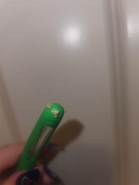 Tonsil Stones From One Tonsil Rtonsilstones