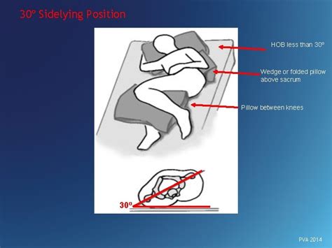 Pressure Mapping For Pressure Ulcer Prevention And Management