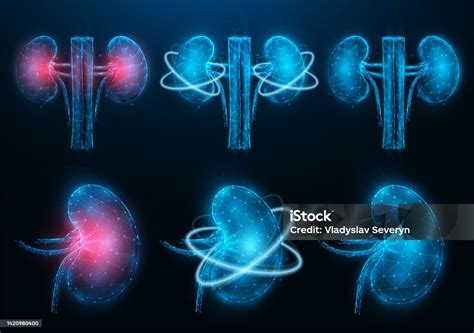 염증이있는 병든 신장 건강한 신장 및 신장 기능의 회복에 대한 다각형 벡터 일러스트 레이 션 세트 내부 장기 낮은 폴리 디자인