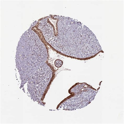 Tissue Expression Of Lgals9 Staining In Cervix The Human Protein Atlas