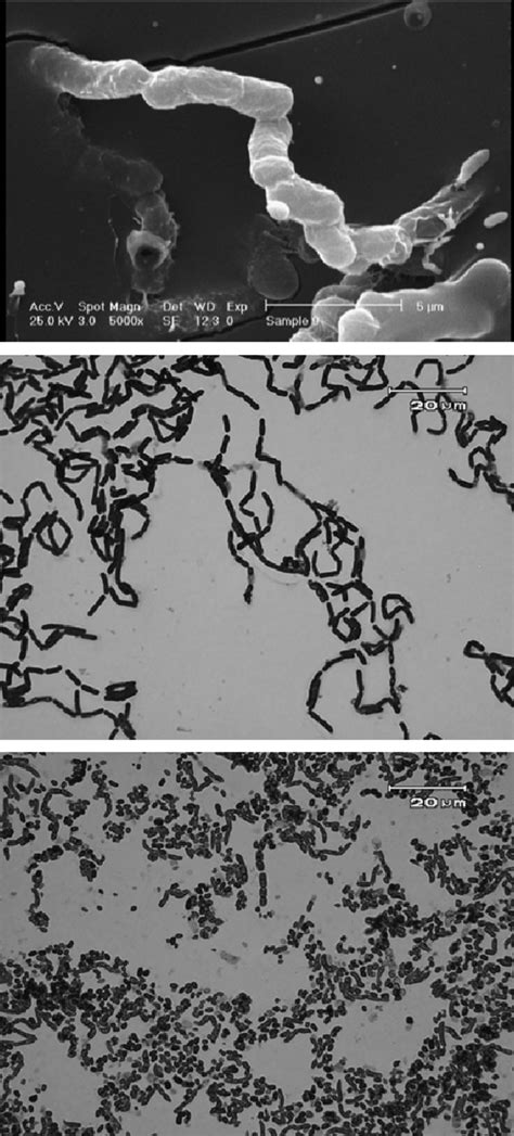 Morphology Of Bacillus Megaterium Who A Scanning Electron Micrograph