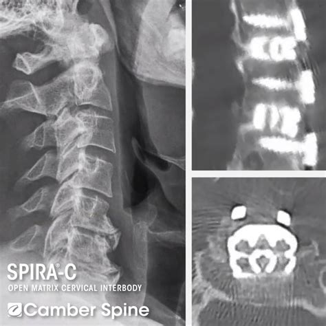 Daniel A Pontecorvo Posted On Linkedin