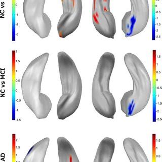 T Value Color Map Is Reported Positive And Negative T Values Represent Download Scientific