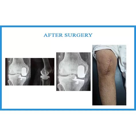 Vora Dr Samir Nanavati