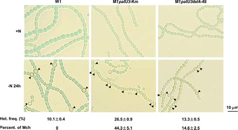 Anabaena Heterocysts