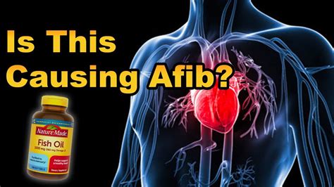 Is This Causing Afib YouTube