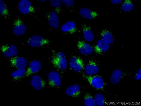 Cd107a Lamp1 Antibody 65051 1 Ig Proteintech