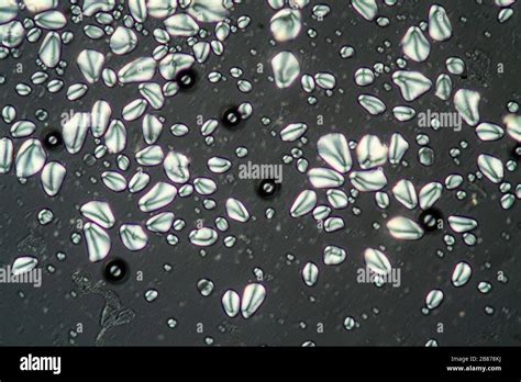 Corn Starch Microscope