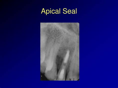 Ppt Mta Case Powerpoint Presentation Free Download Id712903