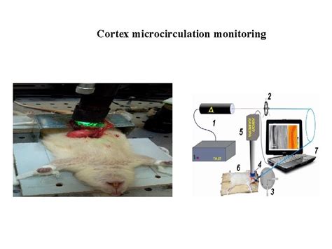 Monitoring Of Microcirculation By Full Field Specklecorrelation Technique