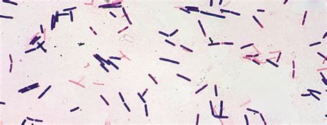 Clostridium Botulinum Gram Positive Stain