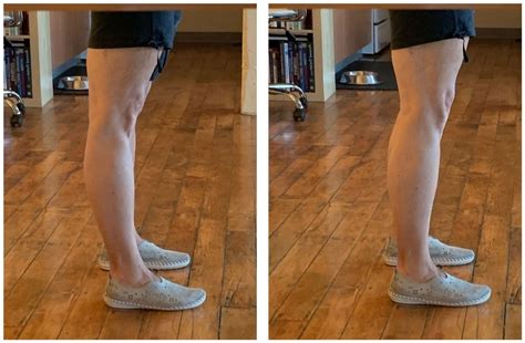 Hypermobility Part 2 Embracing Wonky” Joints Mind 2 Body Fit