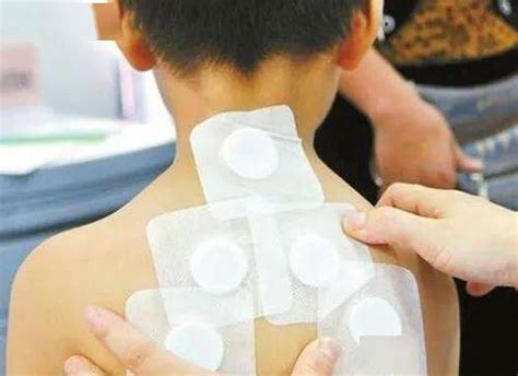 三九贴 潍坊市妇幼保健院三九贴火热预约中 搜狐大视野 搜狐新闻