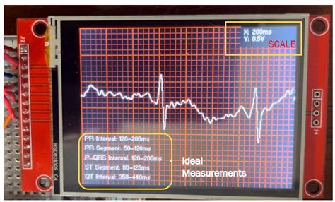 ecg display with arduino 13 steps with pictures instructables