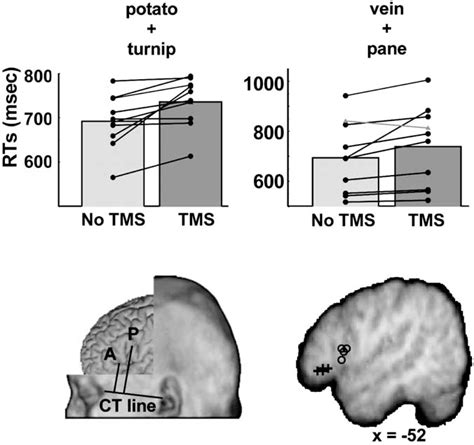 Figure 1 From Dissociating Linguistic Processes In The Left Inferior