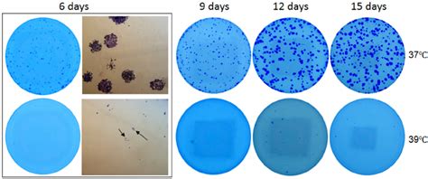 About 1000 Hct116 Cells Were Seeded In Each Of 35 Mm Dishes And Allowed