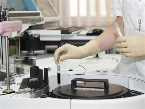 Semen Analysis The Cornerstone Of Testing Male Infertility LifeArt Fertility Clinic