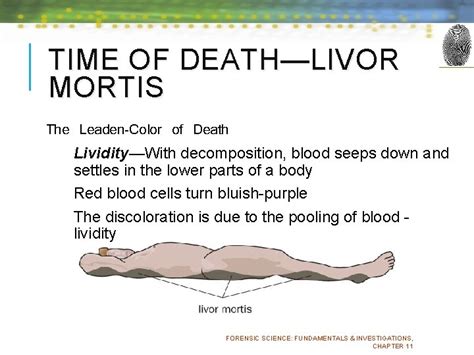 Livor Mortis Stages