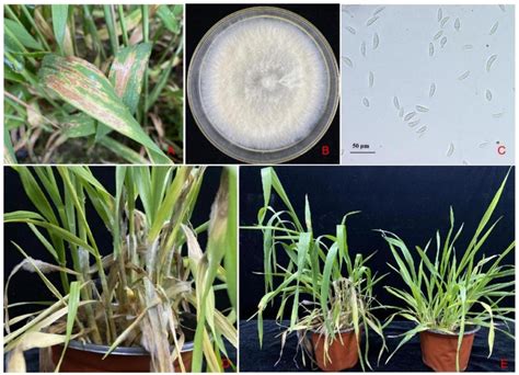 一株贝莱斯芽孢杆菌B2及其在防治小麦叶枯病害中的应用