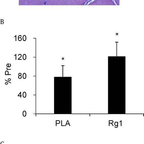 Leukocyte Infiltration In Human Muscle After Exercise A