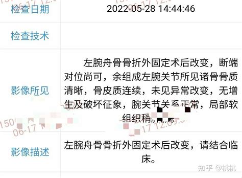 腕手舟骨骨折恢复经历 知乎