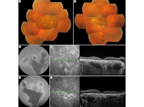 Ophthalmology Notes And Synopses