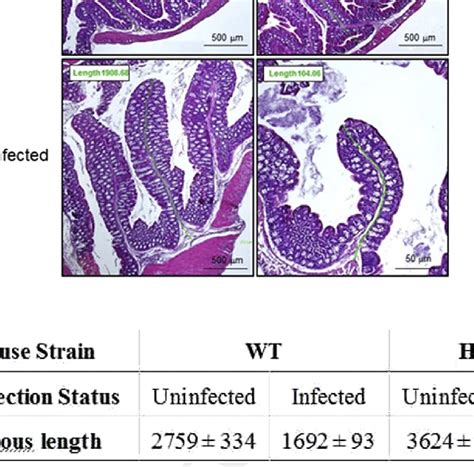 Representative Sections Of Colon Of Uninfected And Infected Wt And