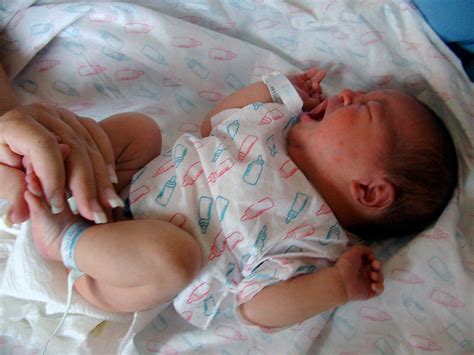 Forceps Birth Injuries Four Things You Need To Know New York
