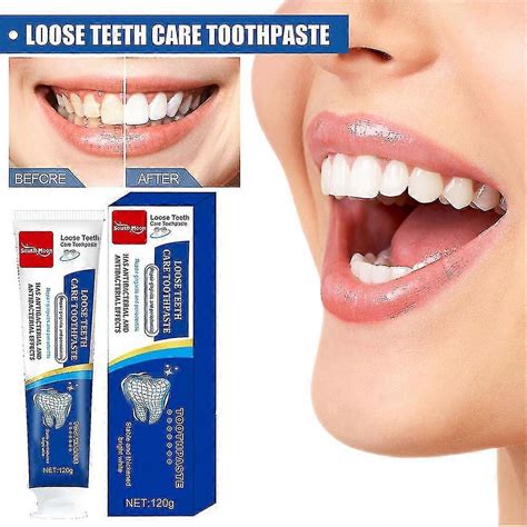South Moon Gingival Fixation Toothpaste Curing Teeth Soothing Gingival