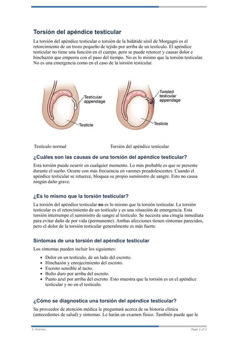 Apendice Testicular