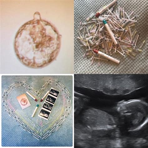 Murray Legg Is Fundraising For Babble Giving