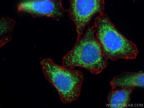 Phospho Gsk3b Ser9 Antibody 67558 1 Ig Proteintech