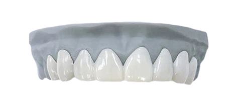 GC Composite Injection Protocol MediMatch Dental Laboratory